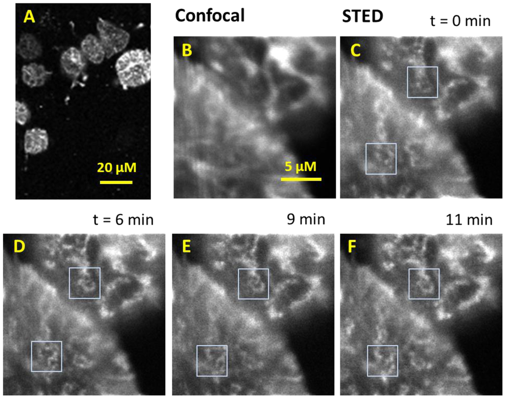 Continuous-Wave Stimulated Emission Depletion Microscope for Imaging ...