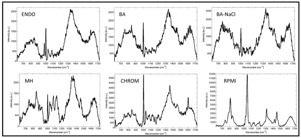 Influence of Culture Media on Microbial Fingerprints Using Raman ...