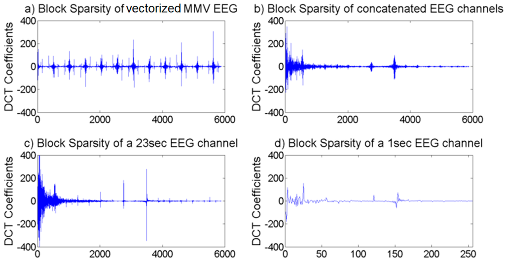 Sensors | Free Full-Text | Block Sparse Compressed Sensing of Electroencephalogram (EEG) Signals ...