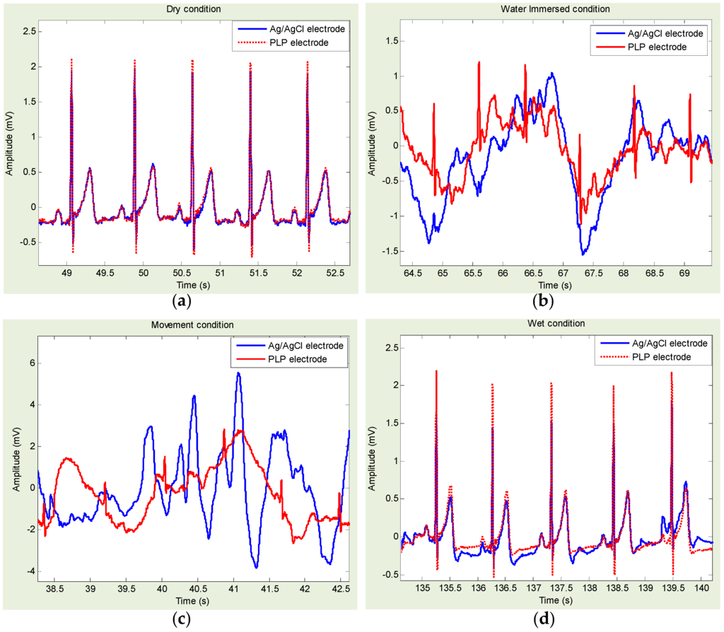 Graphite Based Electrode for ECG Monitoring: Evaluation under ...