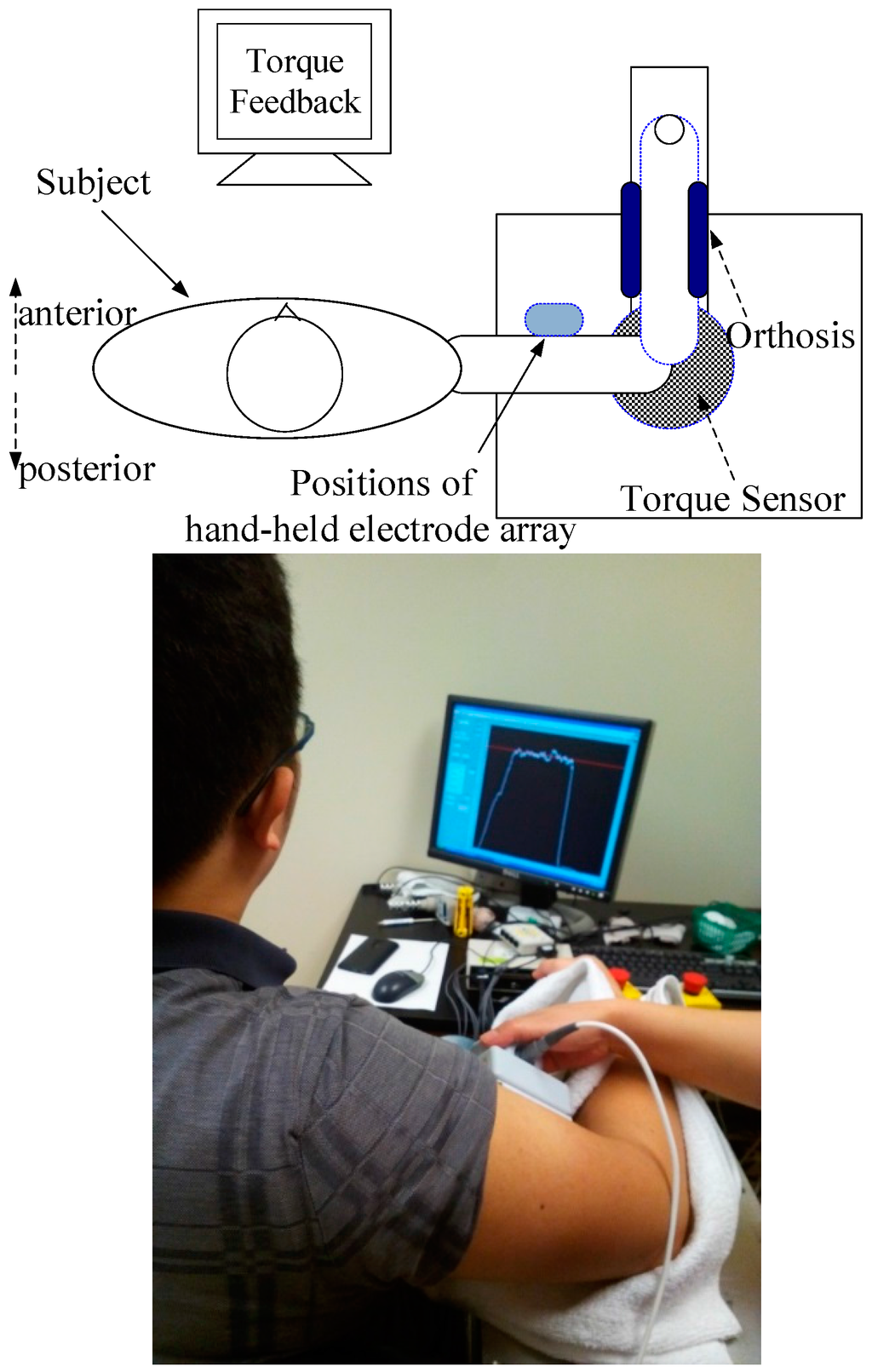 Localized Electrical Impedance Myography of the Biceps Brachii Muscle ...