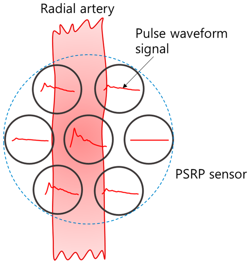 Development of a Tonometric Sensor with a Decoupled Circular Array for Precisely Measuring ...