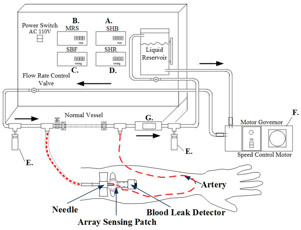 Novel Wearable Device for Blood Leakage Detection during Hemodialysis ...