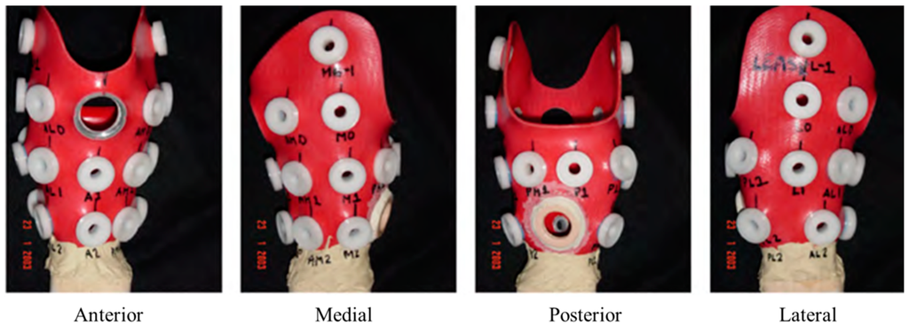 Techniques for Interface Stress Measurements within Prosthetic Sockets ...