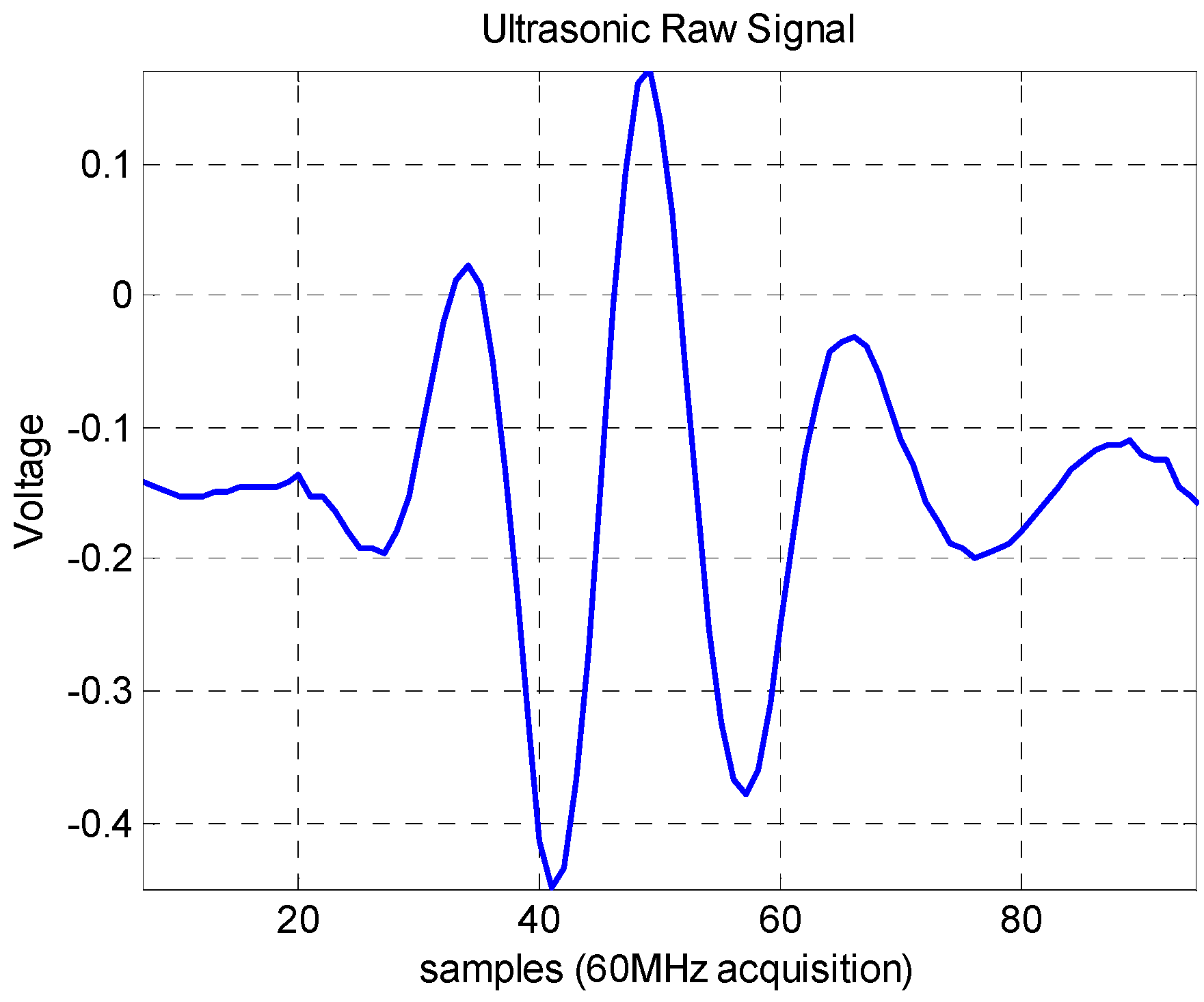 Sensors | Free Full-Text | Evaluation of an Extended Autocorrelation ...