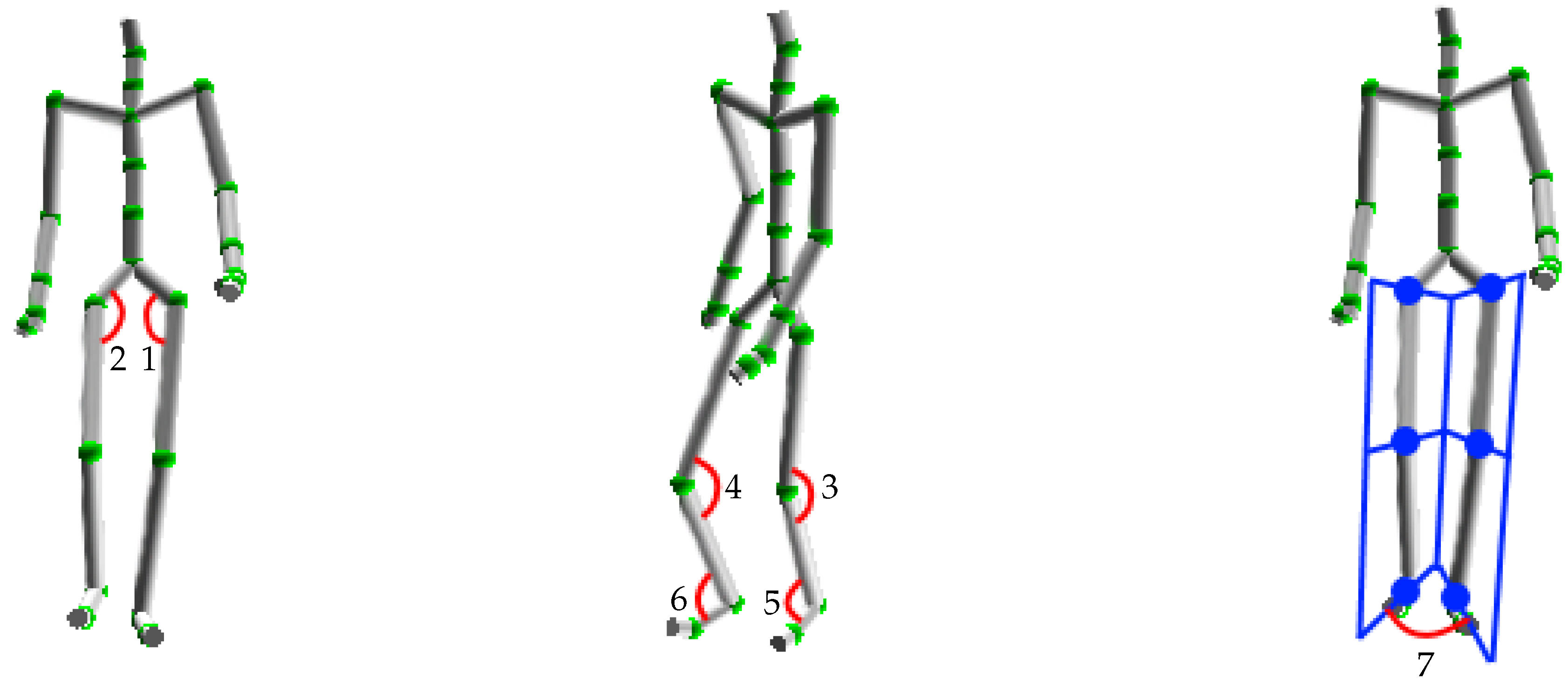 Sensors | Free Full-Text | Skeleton-Based Abnormal Gait Detection