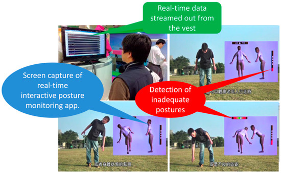 Development of a Wearable Instrumented Vest for Posture Monitoring and ...
