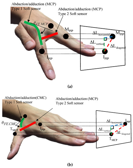 Sensors | Free Full-Text | A Soft Sensor-Based Three-Dimensional (3-D) Finger Motion Measurement ...