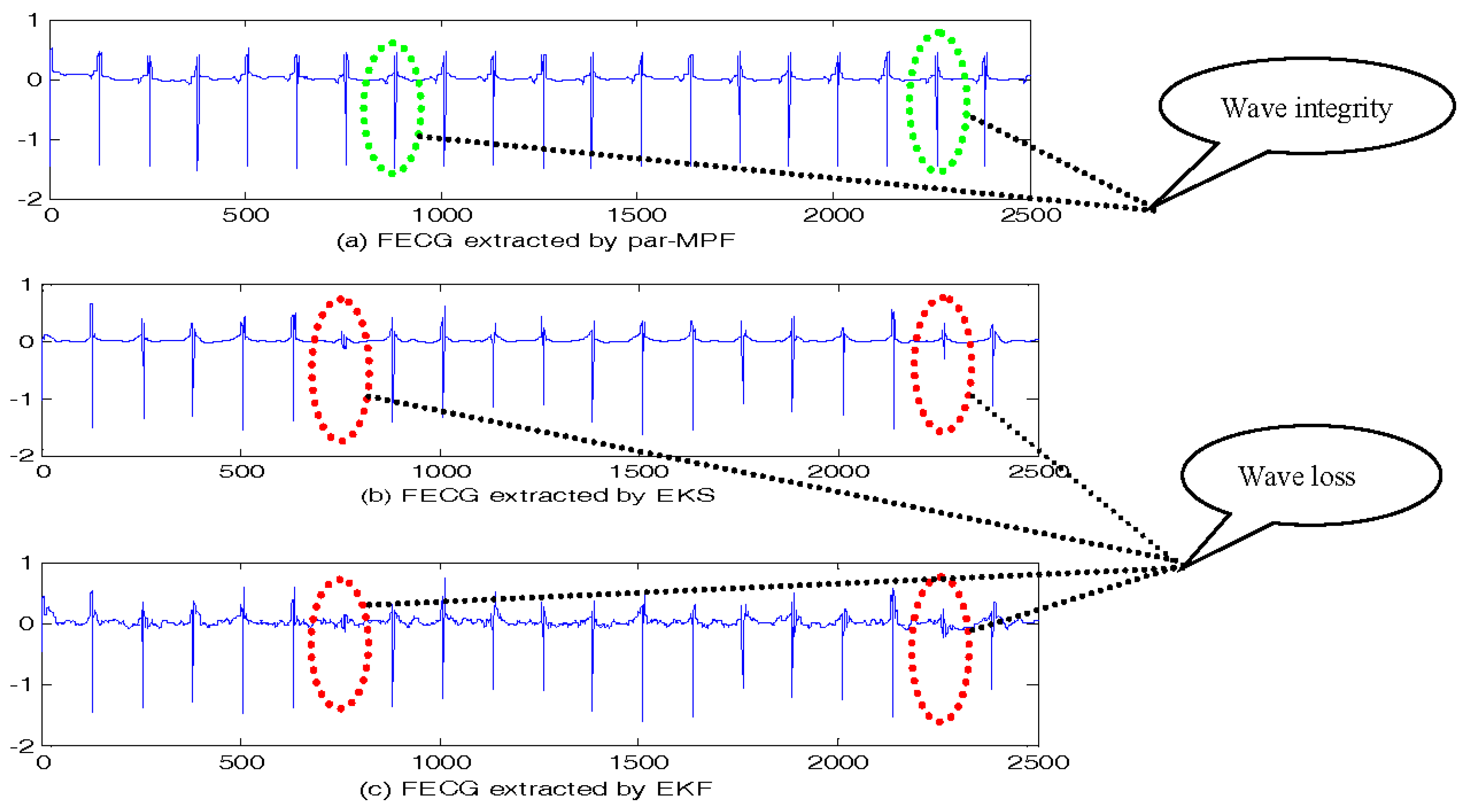 Sensors | Free Full-Text | Single-Lead Fetal ECG Extraction Based on a ... Sensors | Free Full-Text | Single-Lead Fetal ECG Extraction Based on a ...