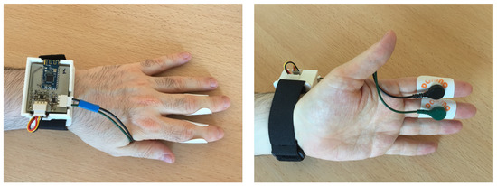 Electrodermal Activity Sensor for Classification of Calm/Distress Condition