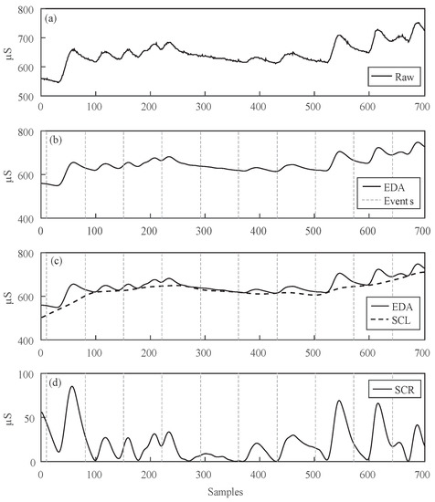 Electrodermal Activity Sensor for Classification of Calm/Distress Condition