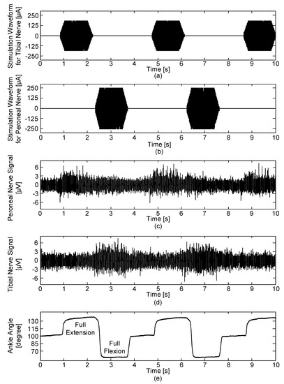 An Implantable Wireless Neural Interface System for Simultaneous ...