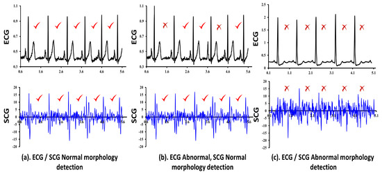 On the Design of an Efficient Cardiac Health Monitoring System Through ...