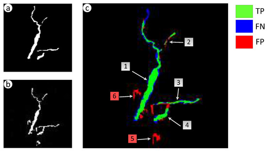 Sensors | Free Full-Text | Automated Landslides Detection for Mountain ...