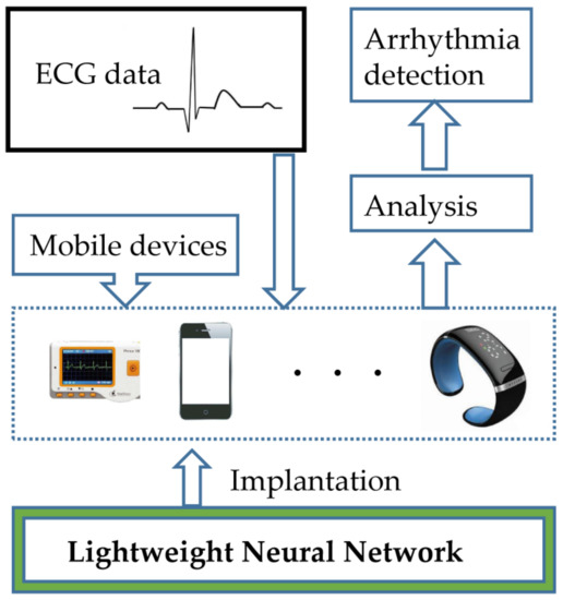 LiteNet: Lightweight Neural Network for Detecting Arrhythmias at ...