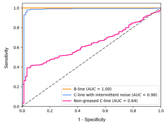 Residual Error Based Anomaly Detection Using Auto-Encoder in SMD Machine Sound
