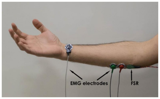 A Piezoresistive Sensor to Measure Muscle Contraction and Mechanomyography