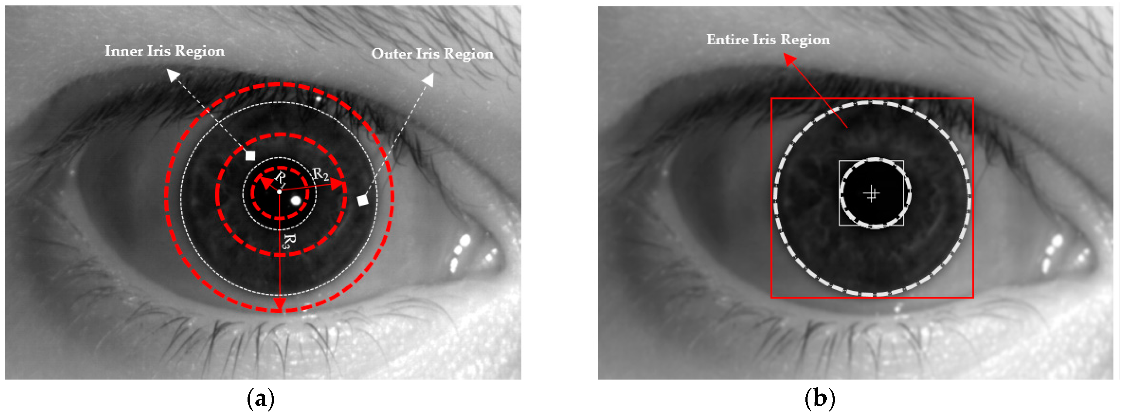 Sensors | Free Full-Text | Deep Learning-Based Enhanced Presentation Attack Detection for Iris ...