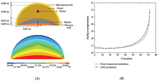 Breast Cancer Detection Using Infrared Thermal Imaging and a Deep ...