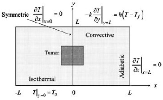 Breast Cancer Detection Using Infrared Thermal Imaging and a Deep ...