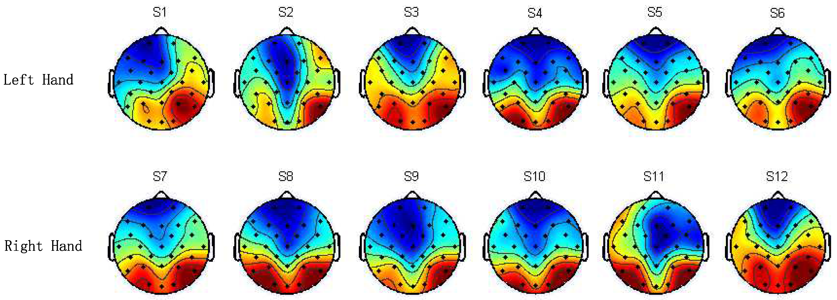 Sensors Free Full Text The Dynamic Eeg Microstates In Mental Rotation