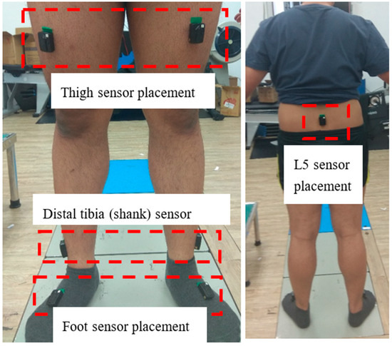 Multiple-Wearable-Sensor-Based Gait Classification and Analysis in Patients with Neurological ...