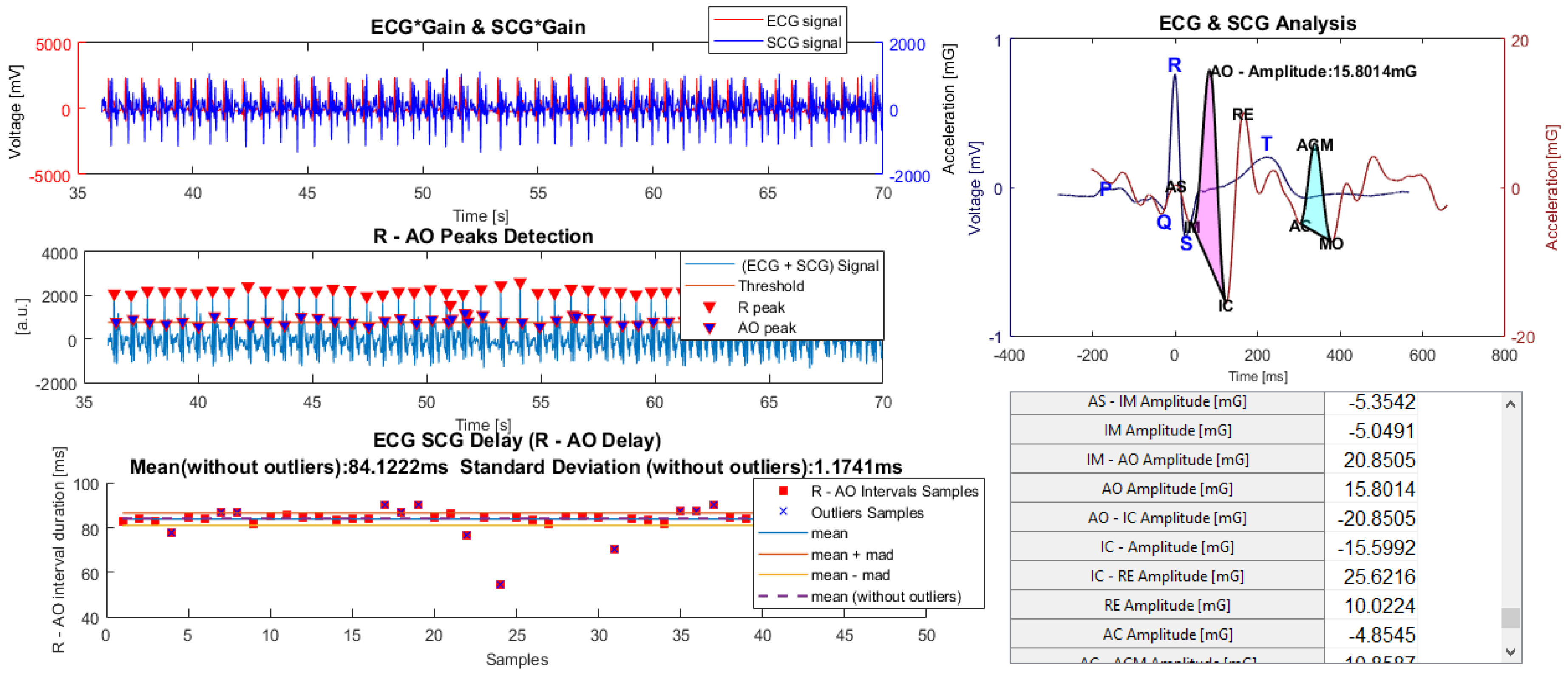 High-Resolution Seismocardiogram Acquisition and Analysis System