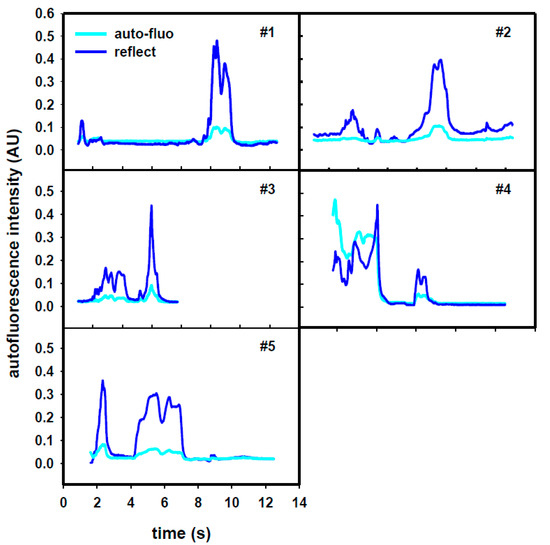 Double Assurance of Epidural Space Detection Using Fiberoptics-Based Needle Design and ...