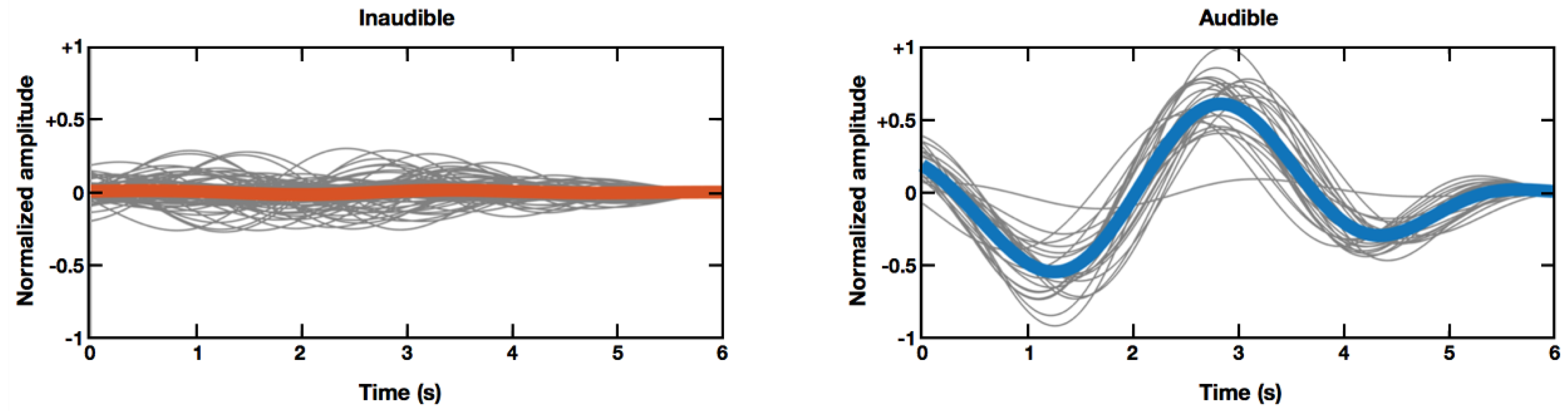 Sensors | Free Full-Text | New Method for Pure-Tone Audiometry Using ...