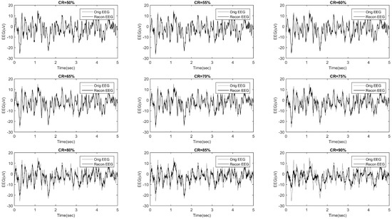 Compressibility of High-Density EEG Signals in Stroke Patients