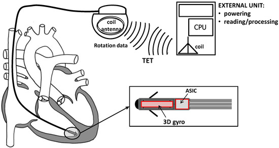 An Implantable Sensorized Lead for Continuous Monitoring of Cardiac ...