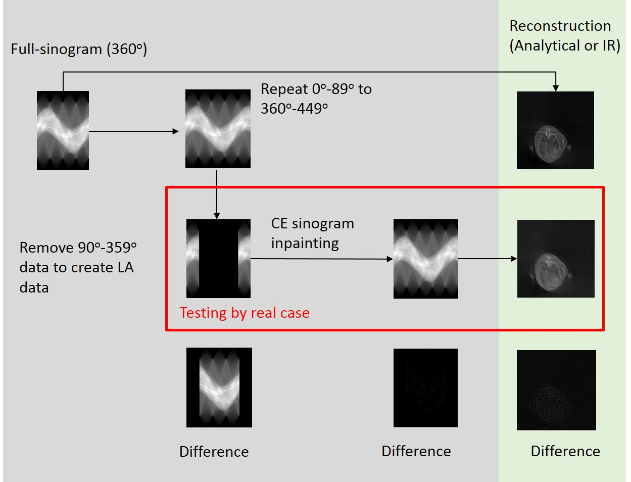 Sensors | Free Full-Text | Development of Limited-Angle Iterative Reconstruction Algorithms with ...