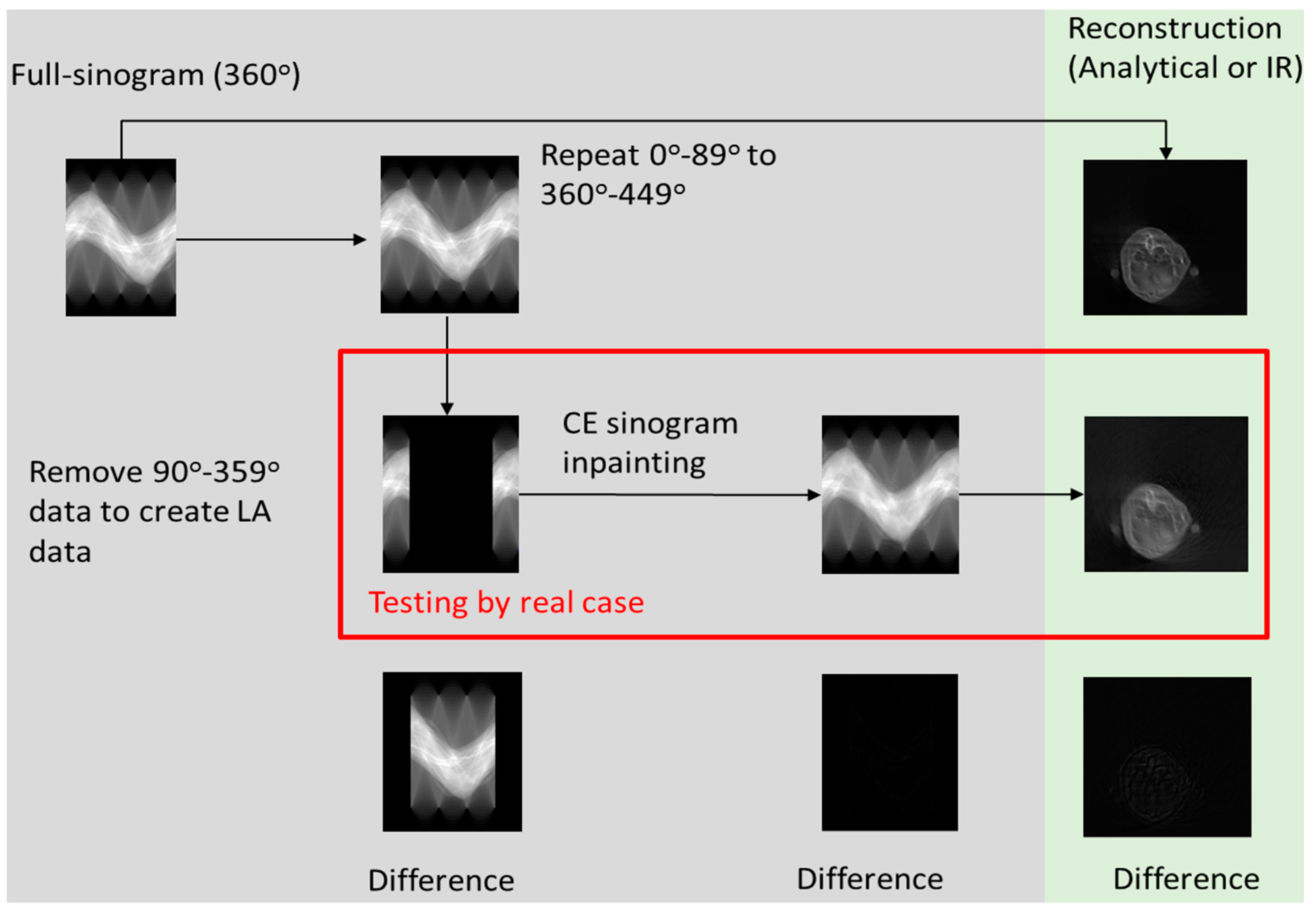 Sensors Free Full Text Development Of Limited Angle Iterative Reconstruction Algorithms With