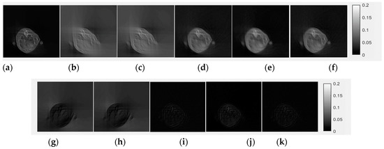 Sensors | Free Full-Text | Development of Limited-Angle Iterative Reconstruction Algorithms with ...