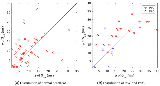 Sensors | Free Full-Text | Efficient Fiducial Point Detection of ECG QRS Complex Based on ...