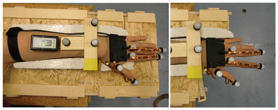 Sensors | Free Full-Text | A Tangible Solution for Hand Motion Tracking ...