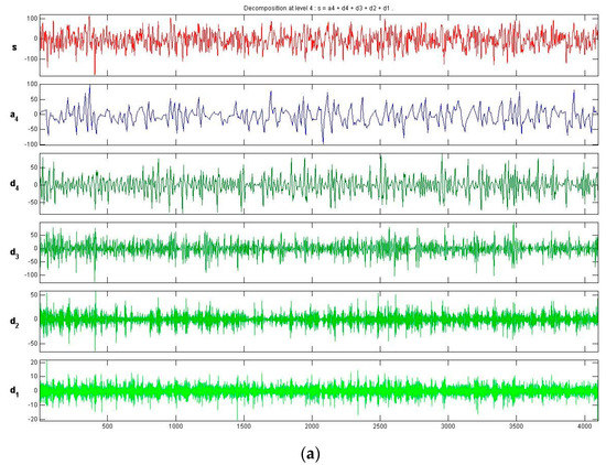 Automated Recognition of Epileptic EEG States Using a Combination of ...