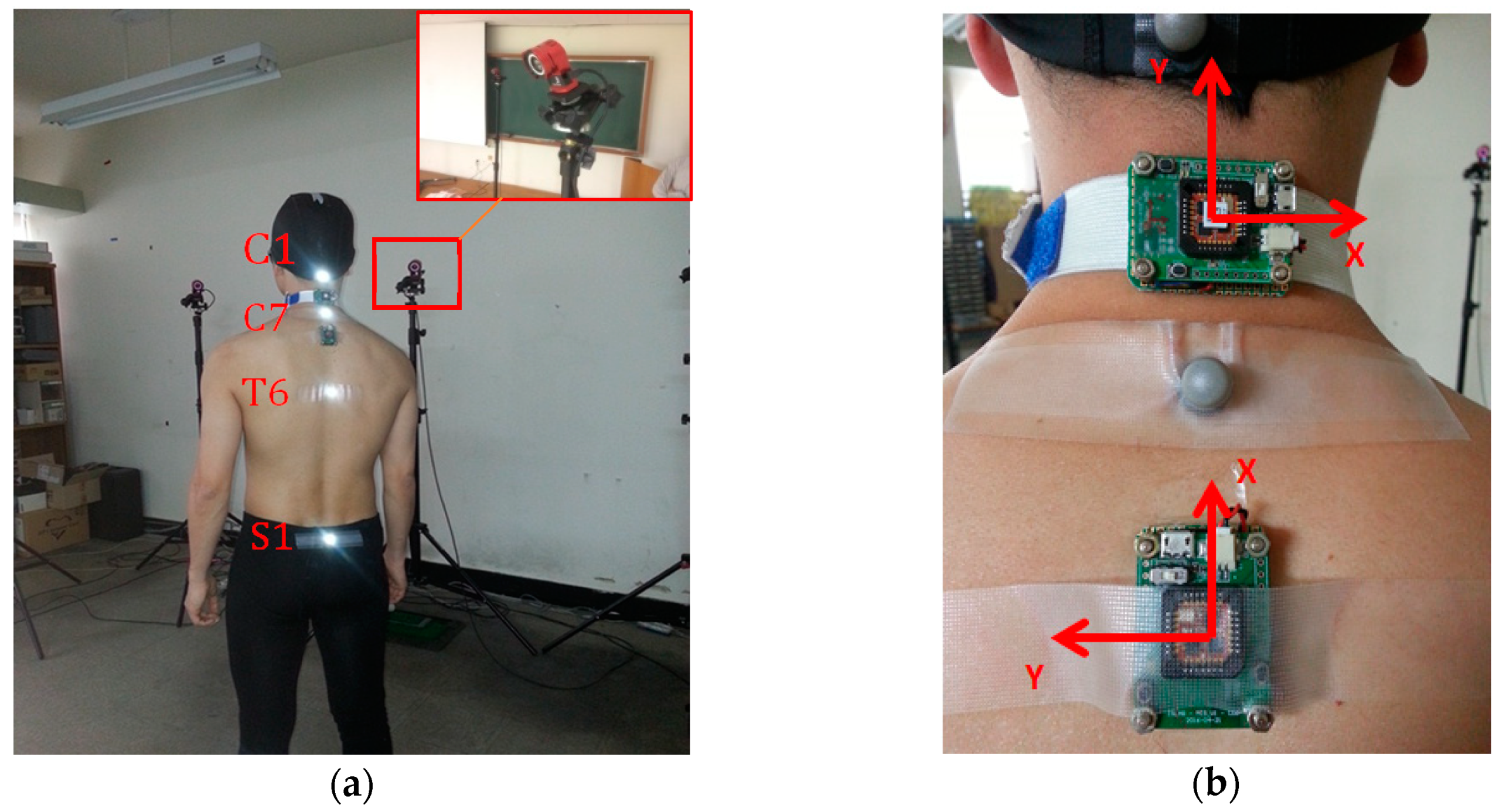 Wearable Sensor Based Stooped Posture Estimation in Simulated Parkinson ...