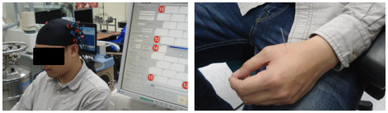 Cortical Network Response to Acupuncture and the Effect of the Hegu ...