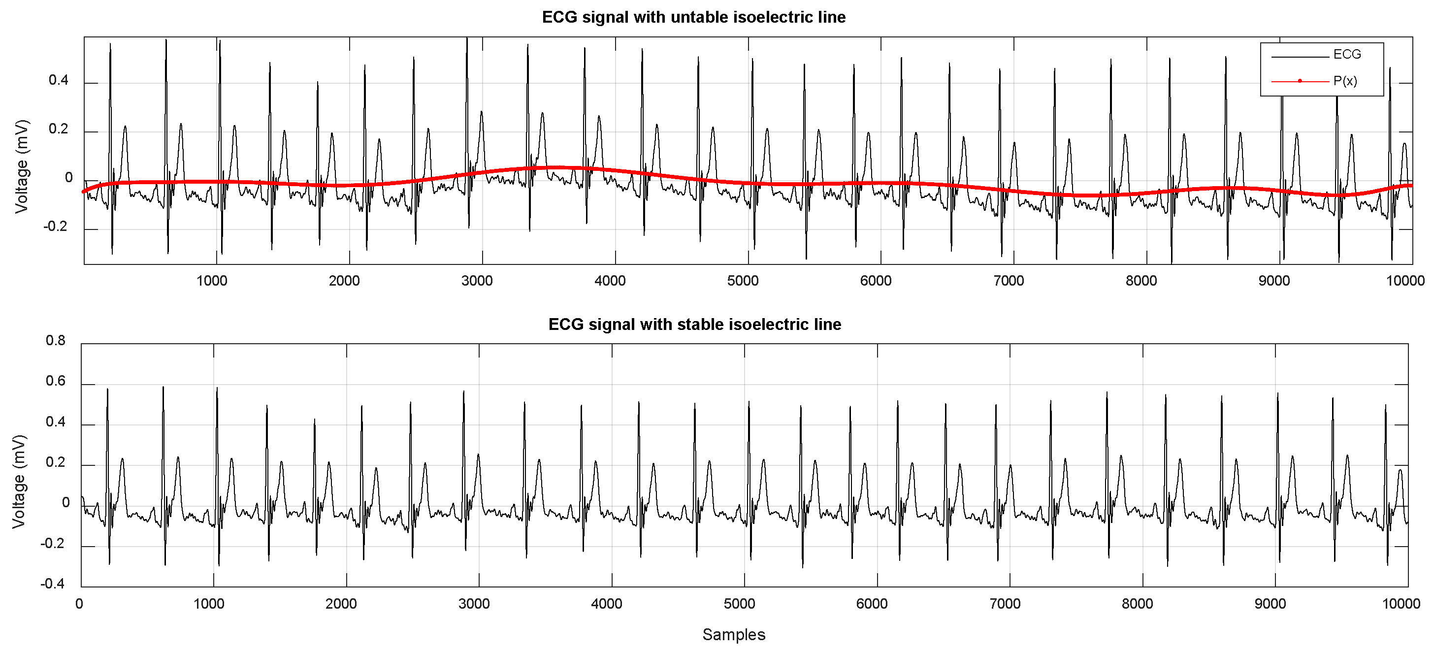 Segmentation of the ECG Signal by Means of a Linear Regression Algorithm