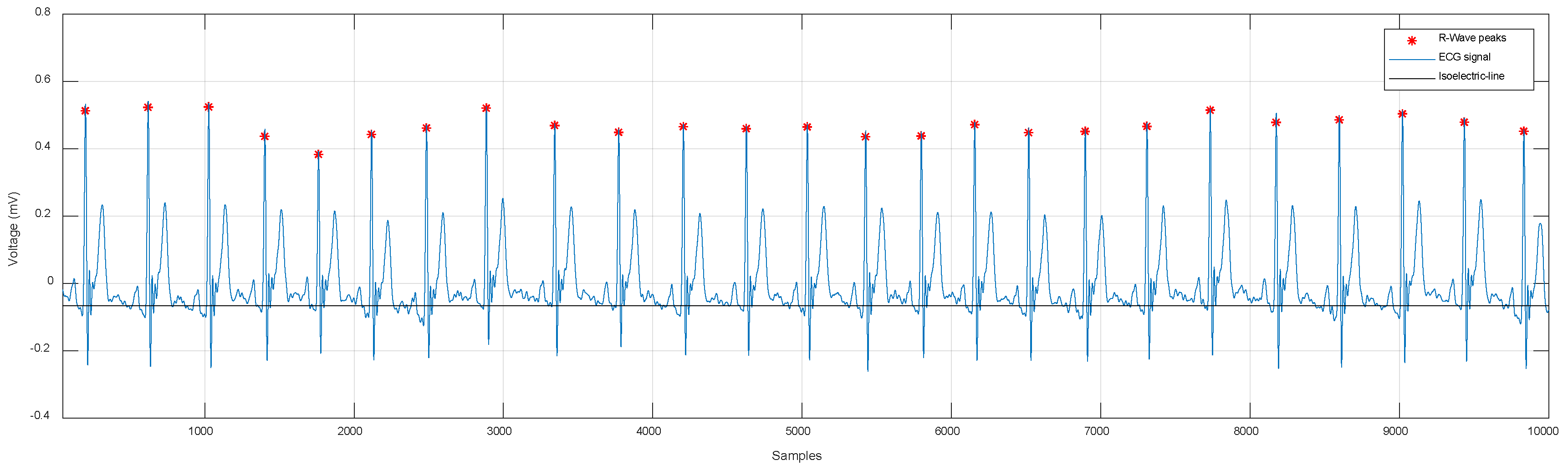 Segmentation of the ECG Signal by Means of a Linear Regression Algorithm