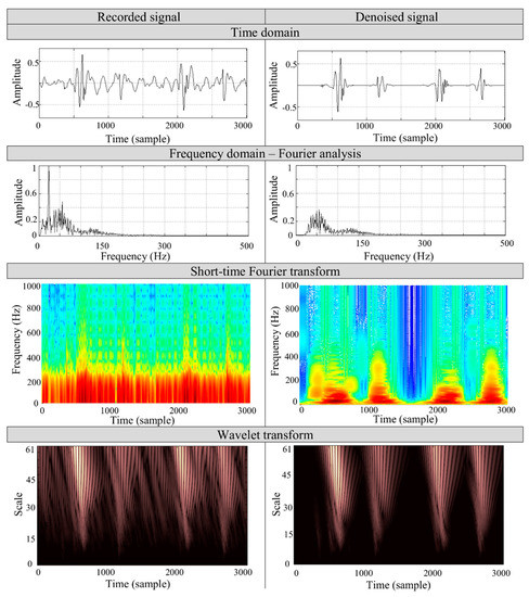 Sensors | Free Full-Text | A Wavelet Transform-Based Neural Network Denoising Algorithm for ...