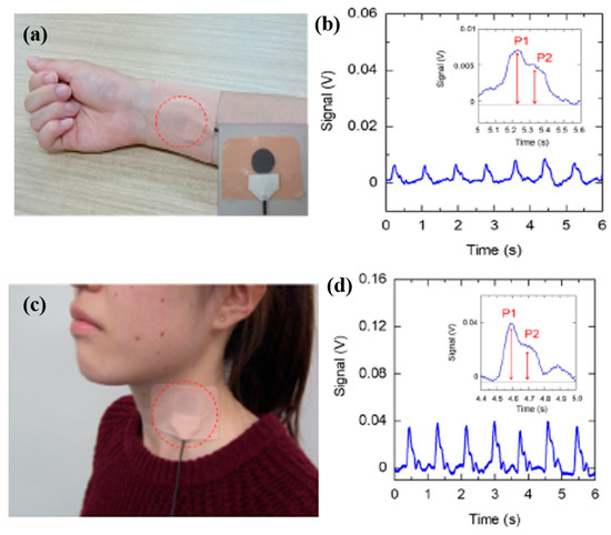 Recent Developments in Printing Flexible and Wearable Sensing ...