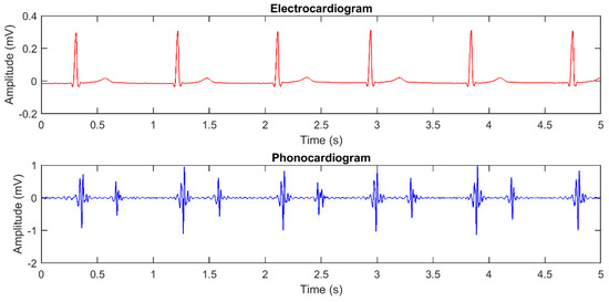 A Novel Method for Measuring the Timing of Heart Sound Components ...