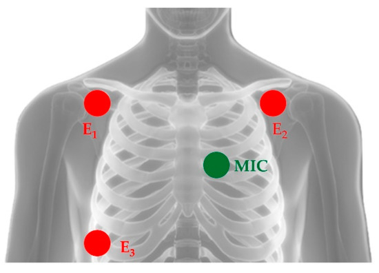 A Novel Method for Measuring the Timing of Heart Sound Components ...