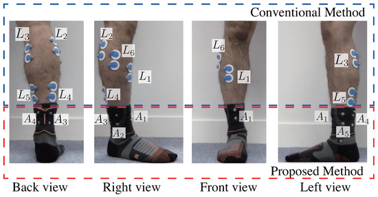Sensors | Free Full-Text | Sock-Type Wearable Sensor for Estimating ...