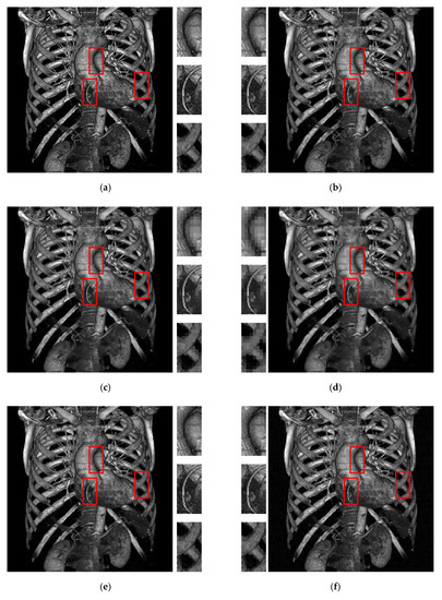 Visual IoT Security: Data Hiding in AMBTC Images Using Block-Wise Embedding Strategy