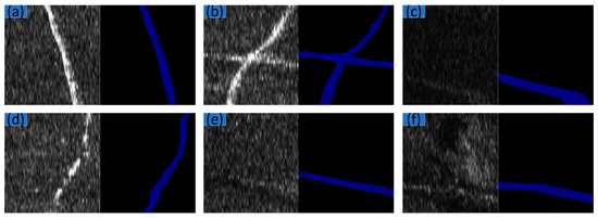Sensors | Free Full-Text | ECNet: Efficient Convolutional Networks for Side Scan Sonar Image ...