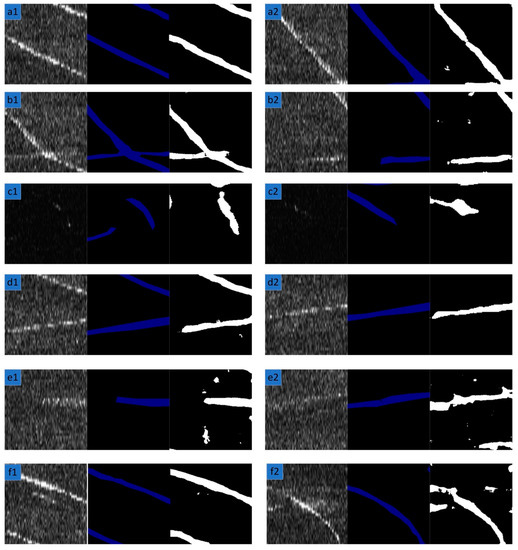 Sensors | Free Full-Text | ECNet: Efficient Convolutional Networks for Side Scan Sonar Image ...