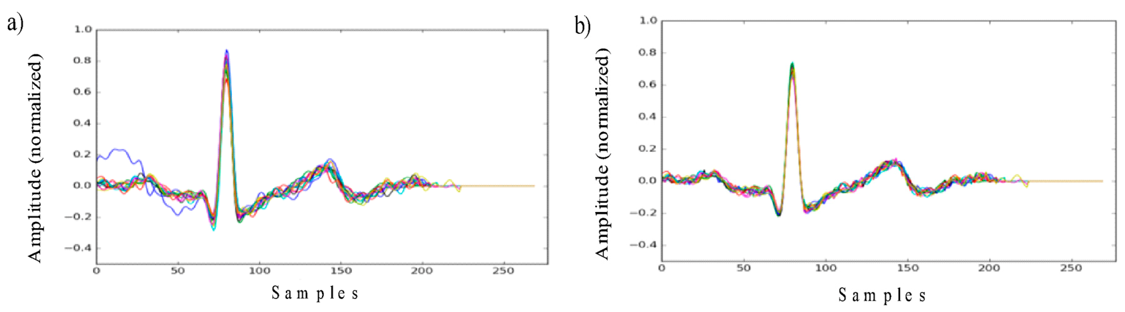 ECG Signal as Robust and Reliable Biometric Marker: Datasets and ...
